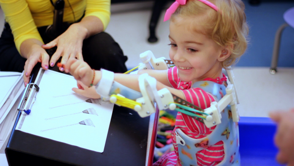 3D PRINTED EXOSKELETON LETS LITTLE GIRL LIFT ARMS, PLAY – Today’s ...